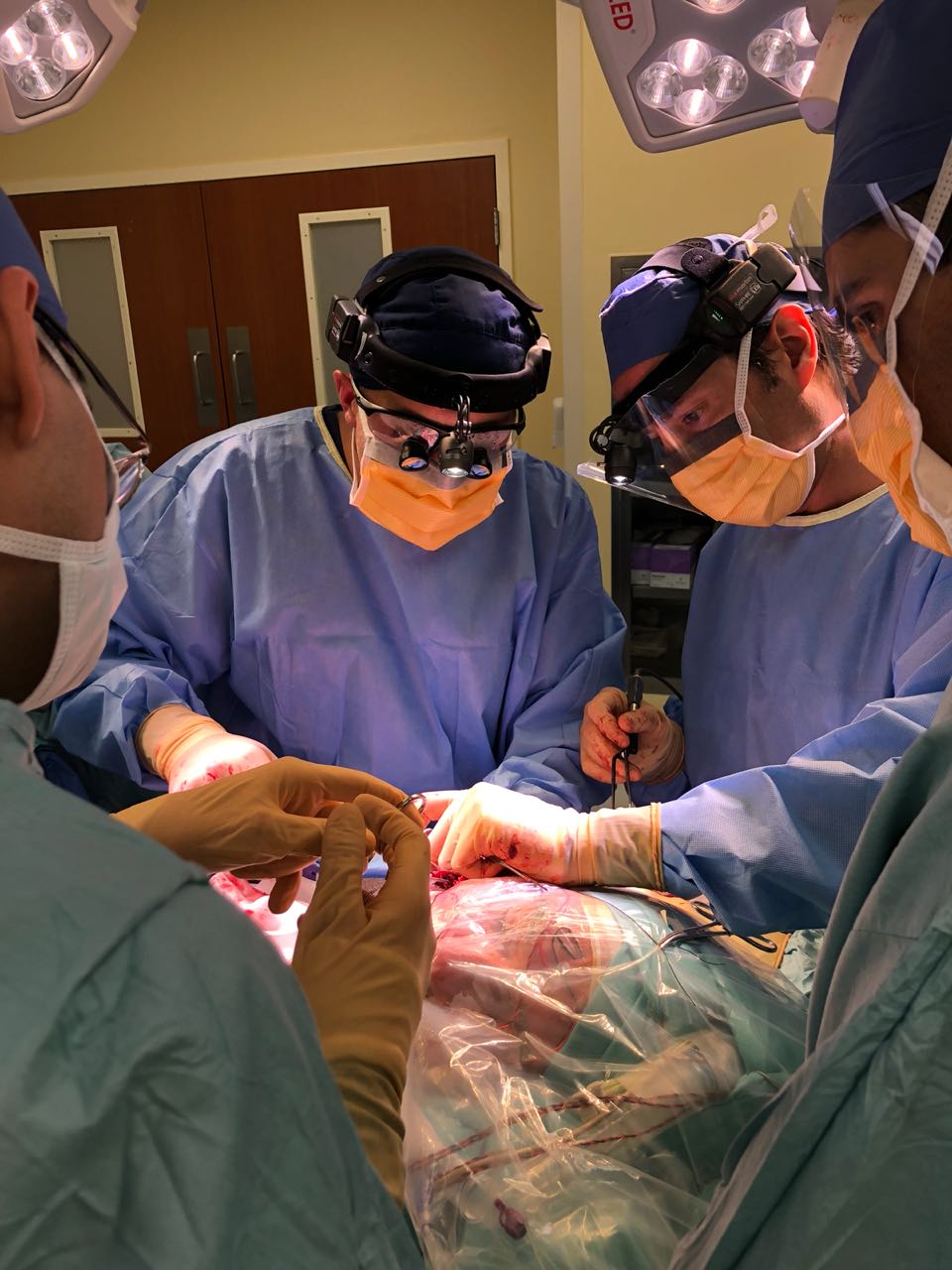 Tumor Mucoepidermoide de Alto Grado de Glándula Parotida Derecha ...