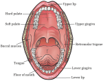 Cancer of the Retromolar Trigone (RMT) – Rodrigo Arrangoiz MS, MD, FACS ...