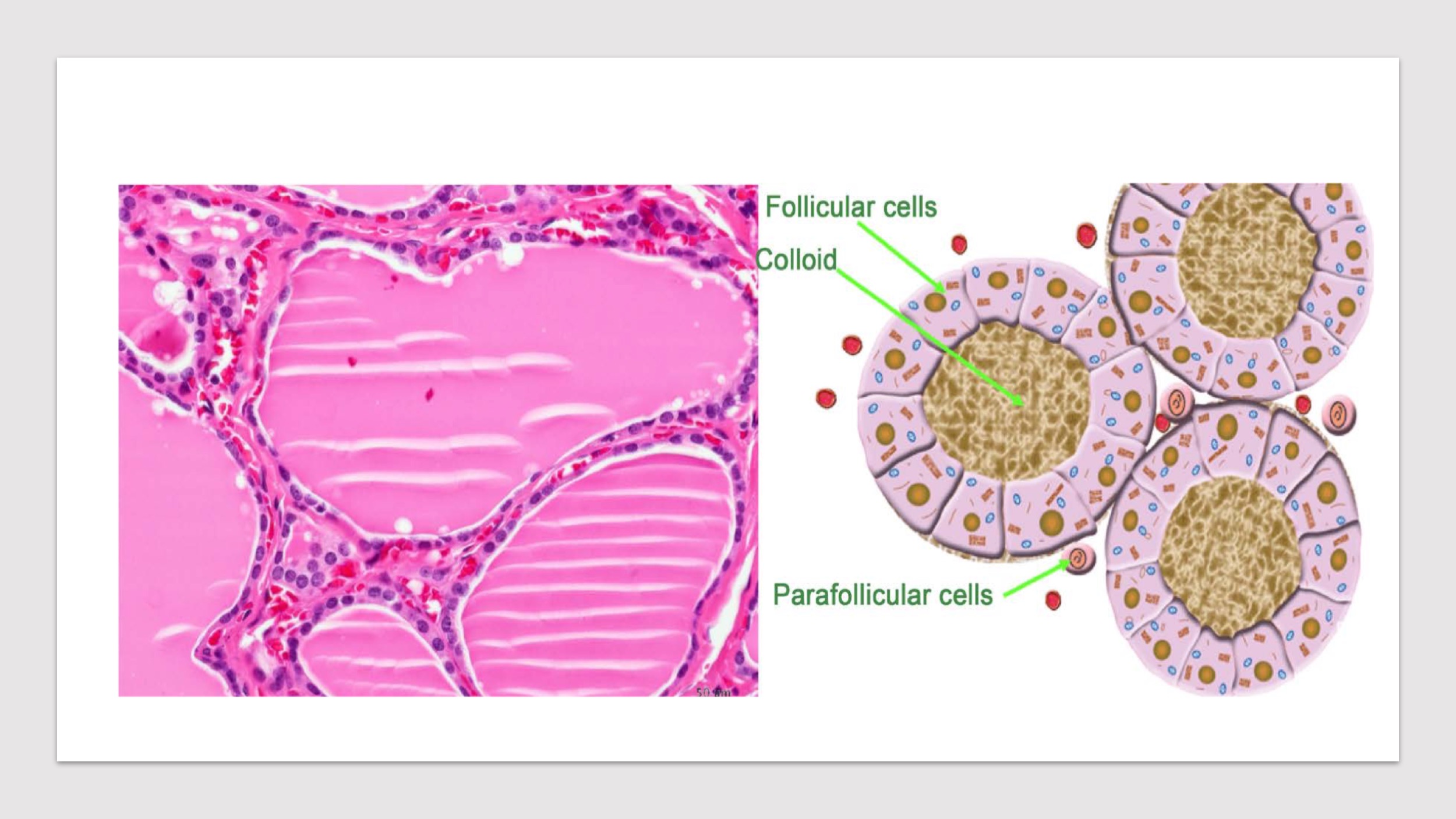 Embryology of the Thyroid Gland – Rodrigo Arrangoiz MS, MD, FACS, FSSO