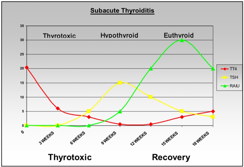 Subacute Thyroiditis – Rodrigo Arrangoiz MS, MD, FACS, FSSO