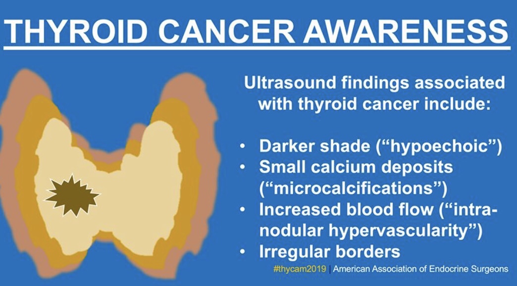 Thyroid Cancer Awareness Month – Ultrasound Findings Associated with ...