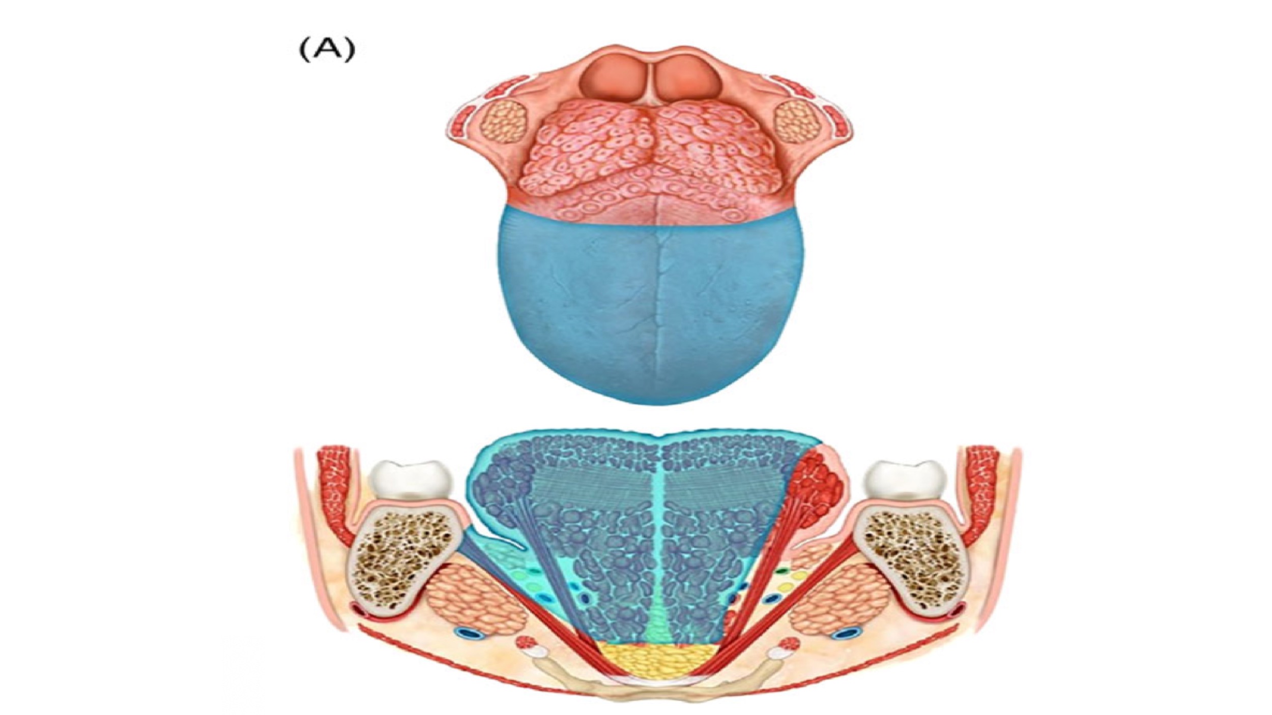 Classification of Glossectomies – Rodrigo Arrangoiz MS, MD, FACS, FSSO