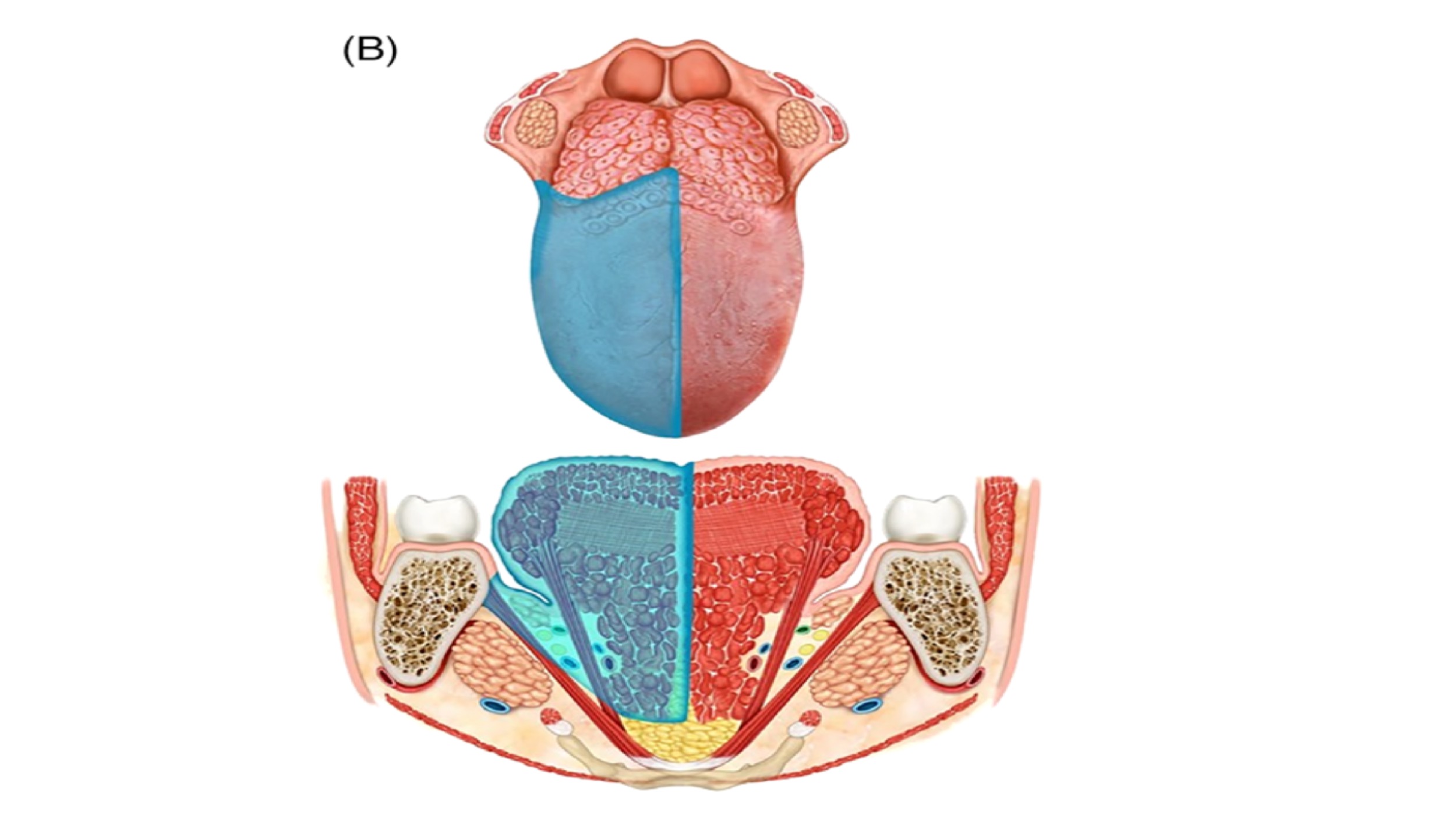 Classification of Glossectomies – Rodrigo Arrangoiz MS, MD, FACS, FSSO