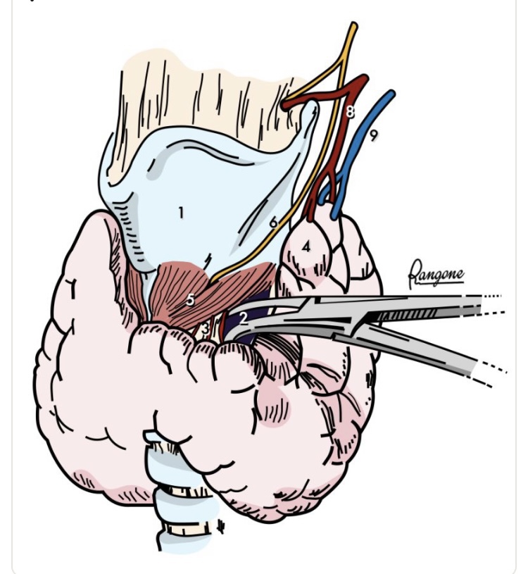 Reeve’s Cricothyroid Space – Rodrigo Arrangoiz MS, MD, FACS, FSSO