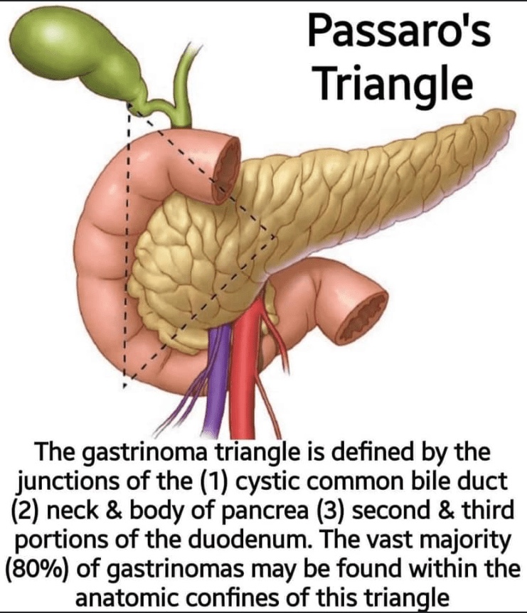 𝗣𝗮𝘀𝘀𝗮𝗿𝗼’𝘀 𝗧𝗿𝗶𝗮𝗻𝗴𝗹𝗲 – Rodrigo Arrangoiz MS, MD, FACS, FSSO