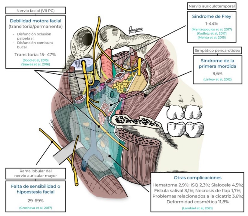Parotid Surgery Complications – Rodrigo Arrangoiz MS, MD, FACS, FSSO