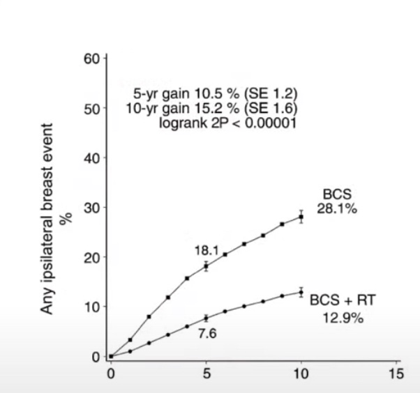 Ductal Carcinoma In Situ (DCIS) Radiation Oncology Perspective Part 1 ...