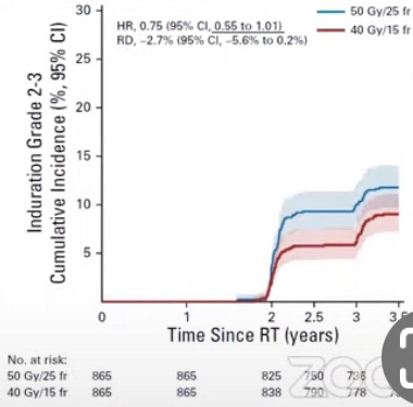 Ductal Carcinoma In Situ (DCIS) Radiation Oncology Perspective Part 3 ...
