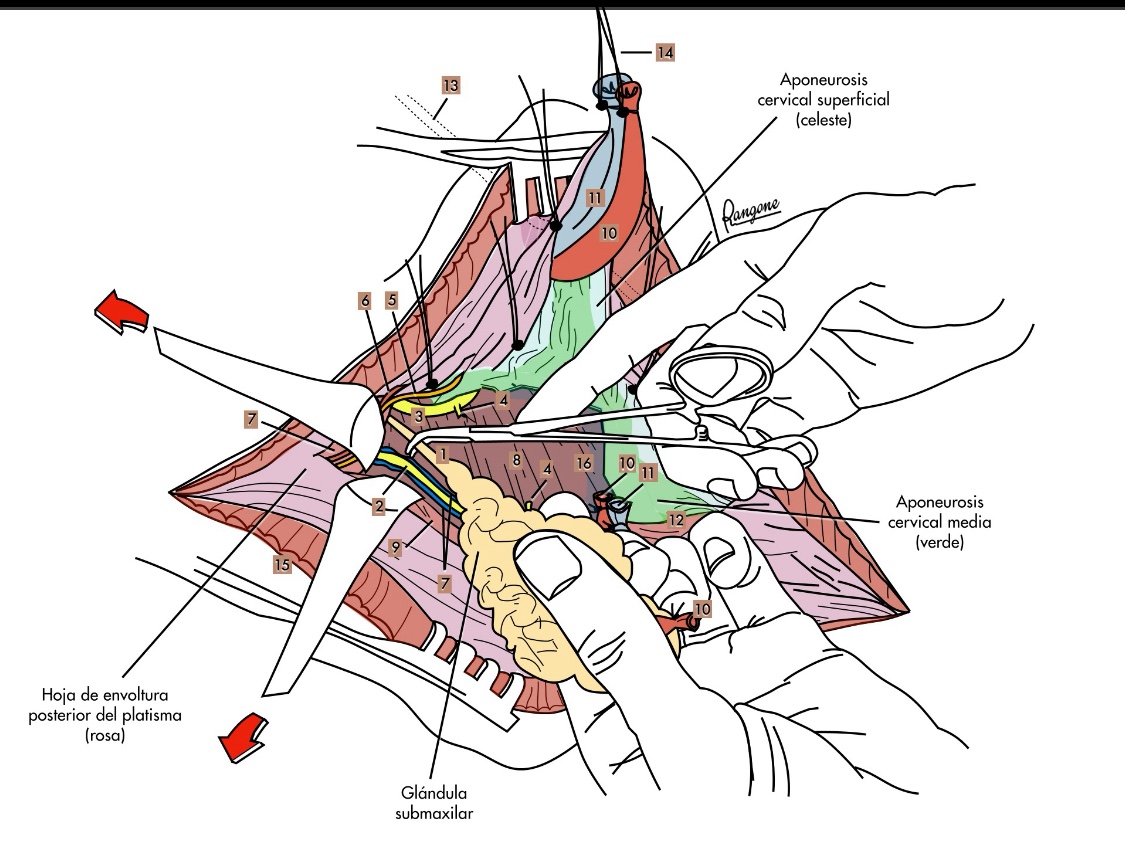 Wharton Duct Ligation During Level 1B Dissection – Rodrigo Arrangoiz MS ...