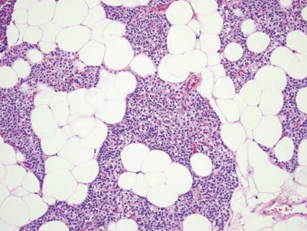 Anatomy and Histology of the Parathyroid Glands – Rodrigo Arrangoiz MS ...