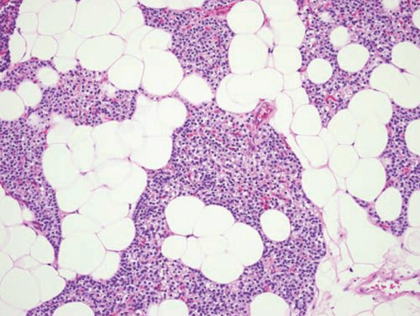 Anatomy and Histology of the Parathyroid Glands – Rodrigo Arrangoiz MS ...